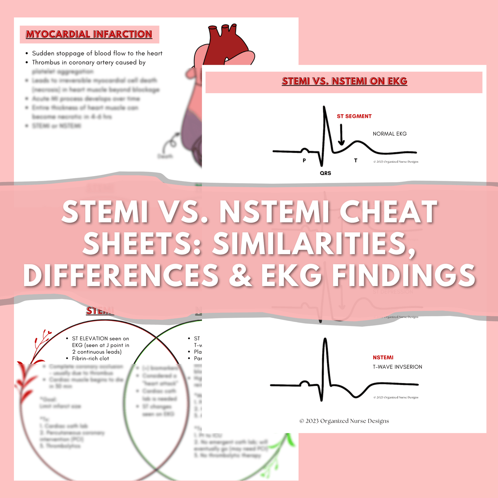 Cardiac Nursing School Study Guide Bundle - EKG & Dysrhythmias ...